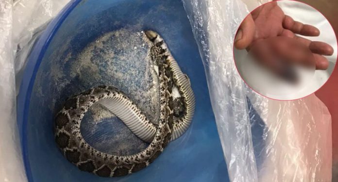 Mordido por cascabel en Monterrey